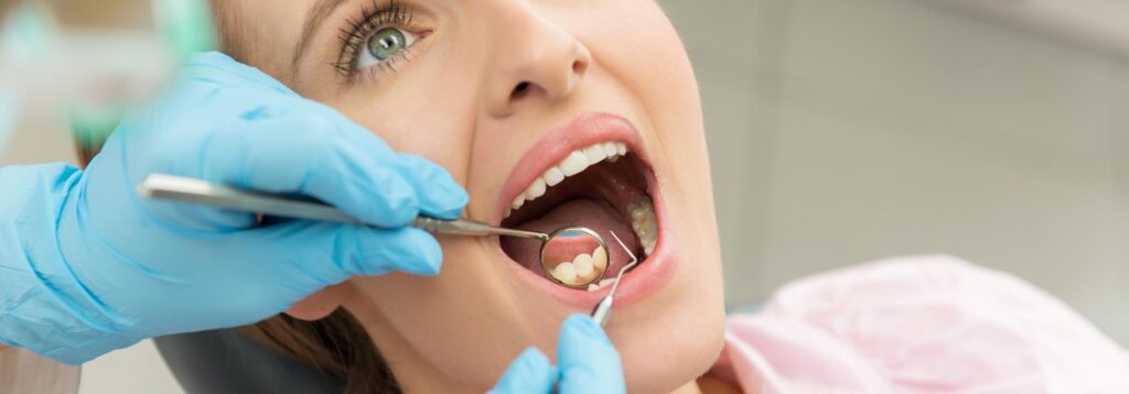 Dental Fillings Sunbury - Composite White Tooth Filling